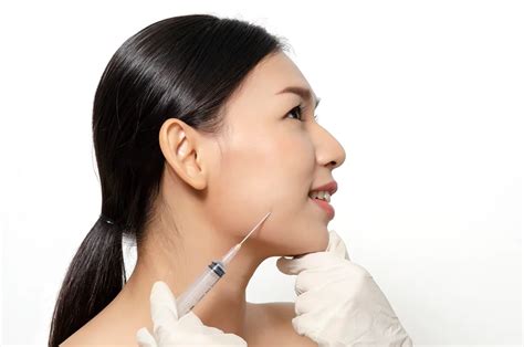How Long Does Swelling From Cheek Fillers Last Doctor Lanna