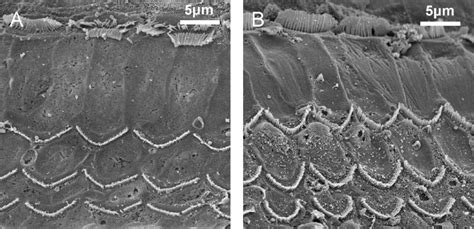 Scanning Electron Micrographs Showing Fixation Using A 10 Neutral Download Scientific