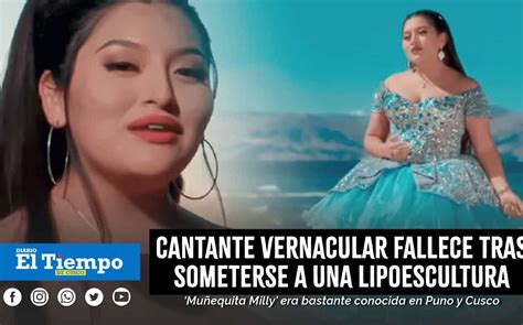 La MuÑequita Milly Fallece Por Hacerse Una LiposucciÓn Diario El