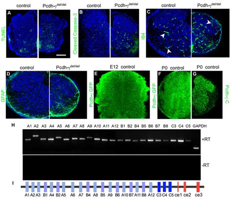 Dorsal Ventral Disparity In Spinal Interneuron Apoptosis In Pcdh γ Null