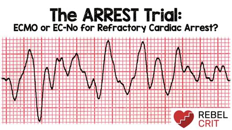 The Arrest Trial Ecmo Or Ec No For Refractory Cardiac Arrest Rebel Em Emergency Medicine Blog