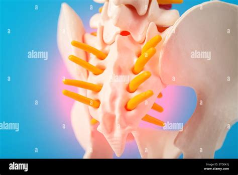 Model Of The Human Spine Section Of The Inflamed Coccyx With Nerves On