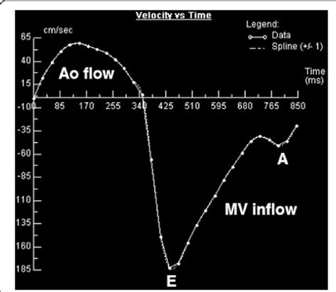 Flow Time Curve Generated By Cmr Phase Contrast Velocity Mapping Across Download Scientific