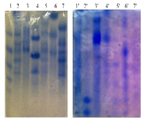 Electrophoregram Of Buffer And Water Soluble Seed Download Scientific Diagram