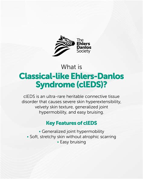 🧬what Is Classical Like The Ehlers Danlos Society