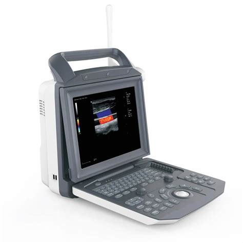 Portable Ultrasound System M5
