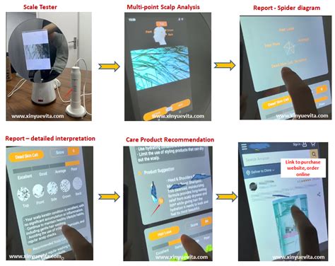 Scalp Skin Analyzer Skin Analyzer