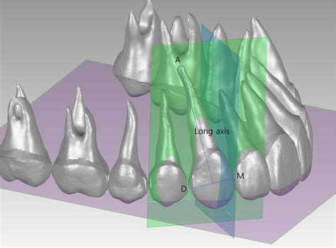 Reference Points And Planes For Angular Measurements Each Tooth Has A