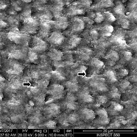 Scanning Electron Micrograph High Magnification ×5000 Of Dentin Download Scientific Diagram
