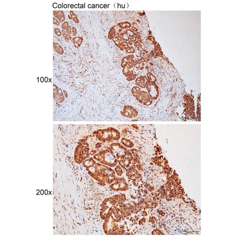 Solarbio K111786p Anti Cer1 Polyclonal Antibody 试剂仪器耗材