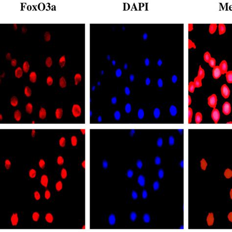 Subcellular Trafficking Of Foxo3a Occurs During Oxidative Stress To