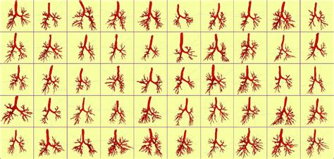 Airways Segmentation On Ct Images With Deep Learning By Rsip Vision