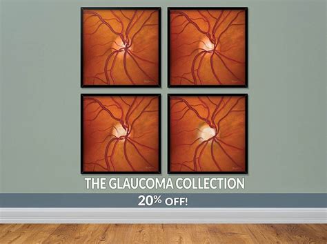 Optic Nerve Cupping Art Print Ts For Glaucoma Doc 816