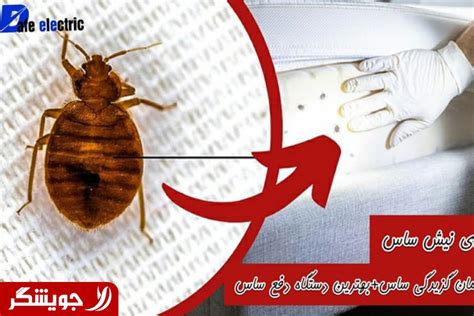 جای نیش ساس چه شکلی است سلامت و پزشکی دندانپزشکی