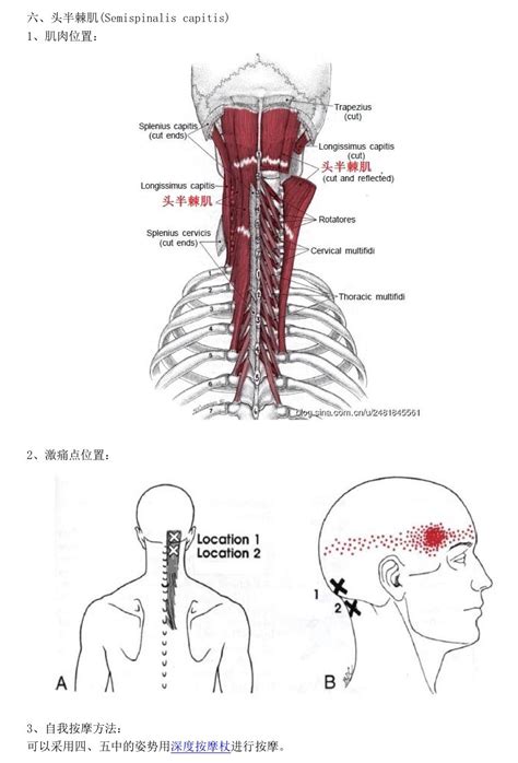 Trigger Points Migraine Headache Tango Trigger Point Therapy