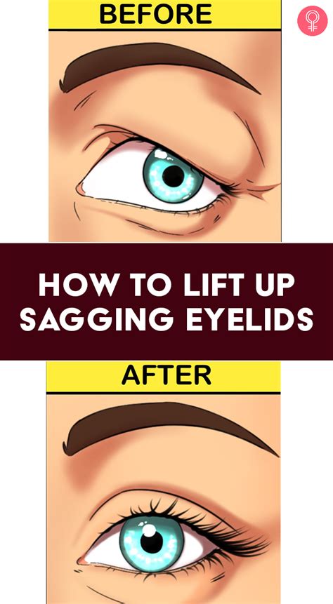 Saggy Eyelids Artofit