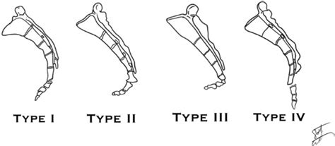 Coccydynia Diagnostic And Management Guidance The Journal For Nurse Practitioners