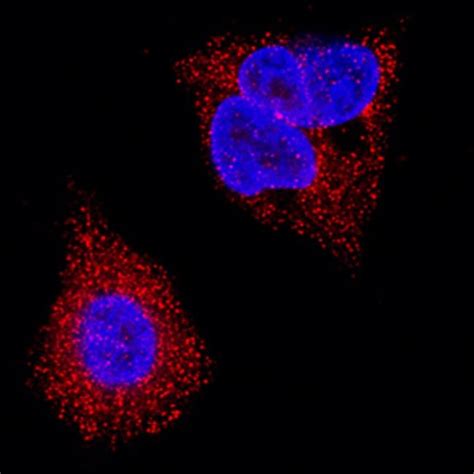 Human Orm2 Antibody Clone 959445 100μg Unlabeledantibodies