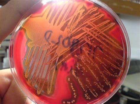 Infectious Disease Blog June 2011
