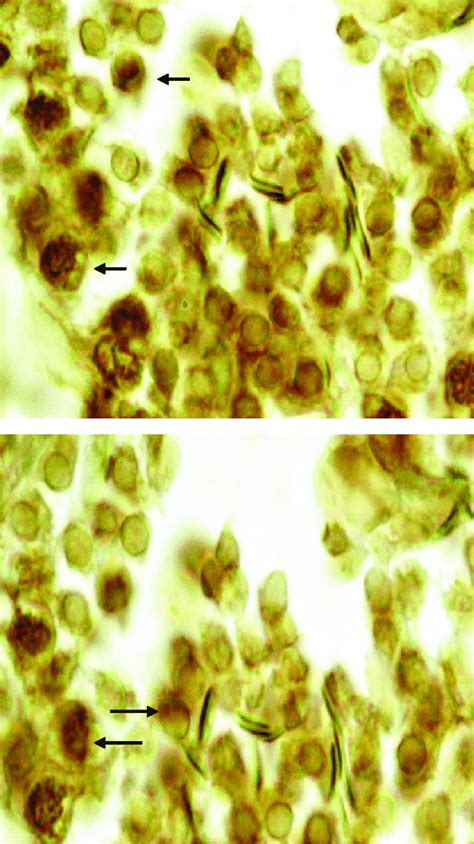 Photomicrograph Of Tunel Stained Apoptotic Cells A Showing The Single