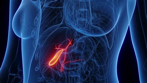 Urinary Stones Videos And Hd Footage Getty Images