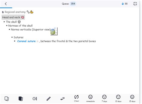 Huge Bug In The Scheduler Am I Alone Remnote Remnote