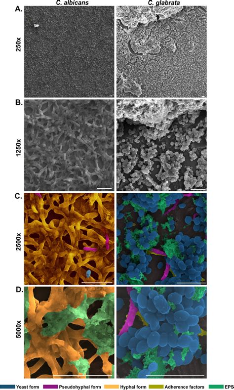 Sem Imaging Of Biofilm Formation Of C Albicans And C Glabrata On