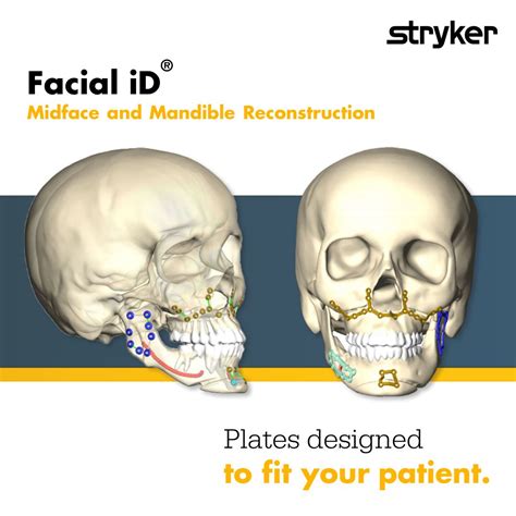Rob Robbins Ms Posted On Linkedin
