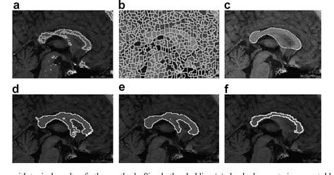 Figure 1 From Watershed Segmentation Using Prior Shape And Appearance