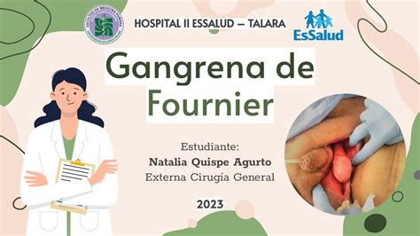 Gangrena De Fournier Natalia Fernanda Quispe Agurto Udocz