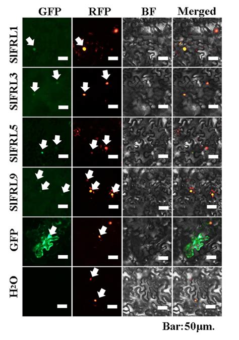 The Subcellular Localization Of Sifrls Bar 50μm Download Scientific Diagram