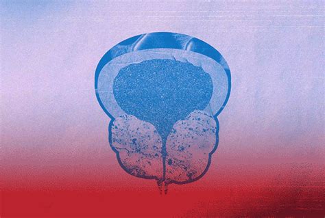 If You Want Prostate Problems Ignore Your General Health