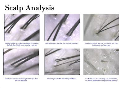 Hair And Scalp Wellness Sample Scalp Analysis