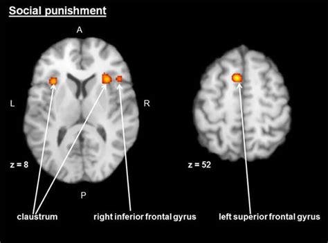 brain mapping lab on linkedin nbml brain mapping brain neuroscience news punishment…