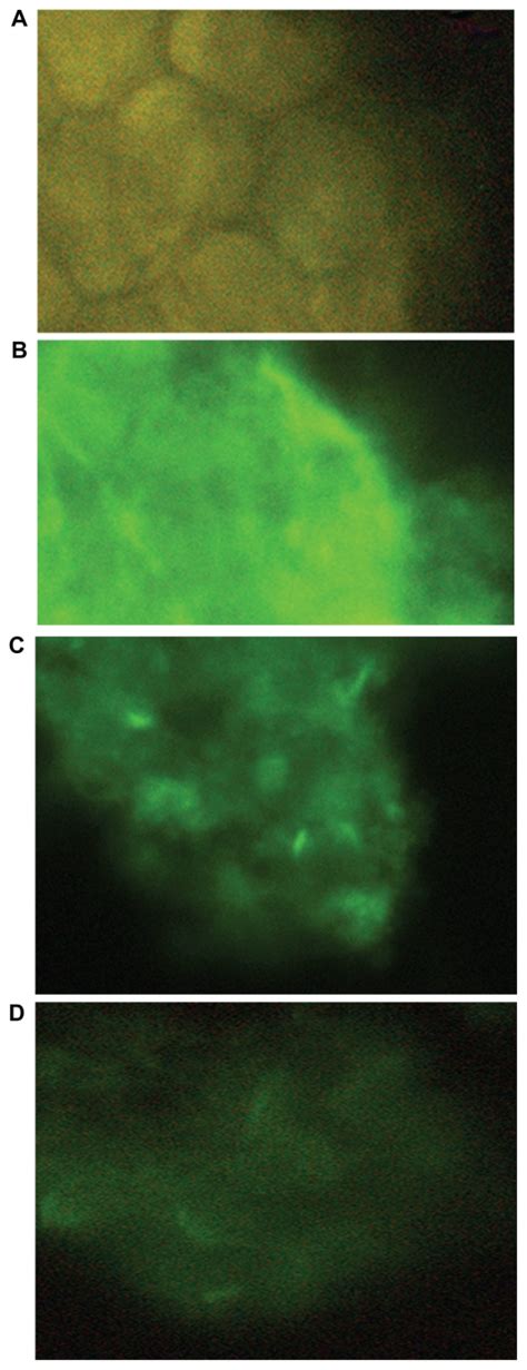 Effects Of Cxcr4 Sirnadextran Spermine Nanoparticles On Cxcr4