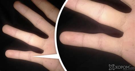 Ухаалаг гар утас хэтэрхий их хэрэглэснээс болж хүний биед үүсдэг 7