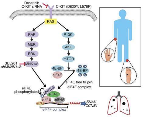 Jci Mnk Inhibition Limits Oncogenicity And Metastasis Of Kit
