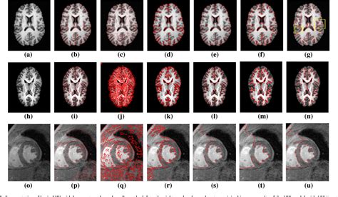 Figure 1 From A Robust Patch Statistical Active Contour Model For Image