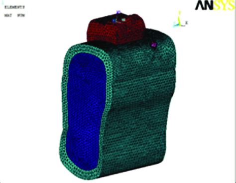 Finite Element Method Model With Mini Implant Mesial To Mandibular