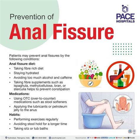 Anal Fissure Symptoms Causes Types Complications 59 Off
