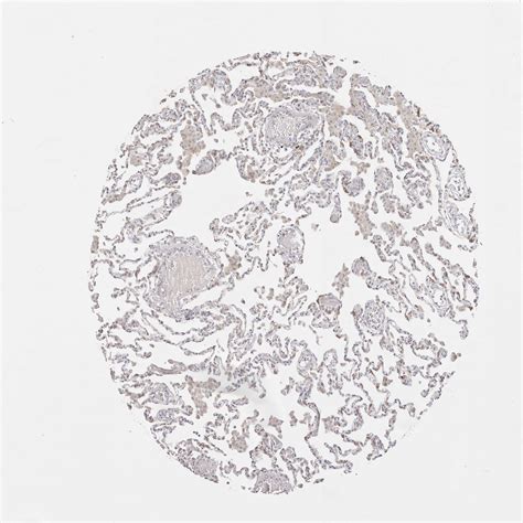 Tissue Expression Of Epcam Staining In Lung The Human Protein Atlas