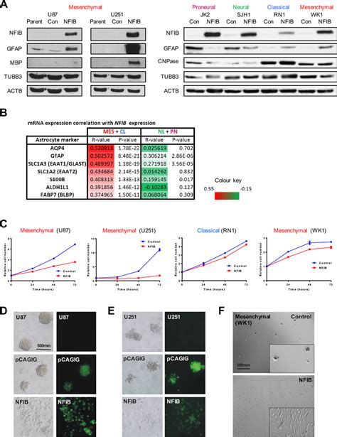 Ectopic Expression Of NFIB In Human Mesenchymal GBM Induces Download Scientific Diagram