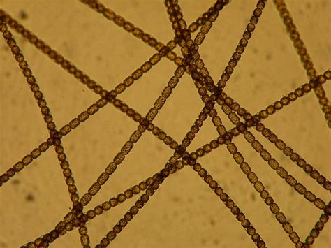 Microplastics Found In Heavily Contaminated Arctic Ice Algae Threaten Human Food Chains