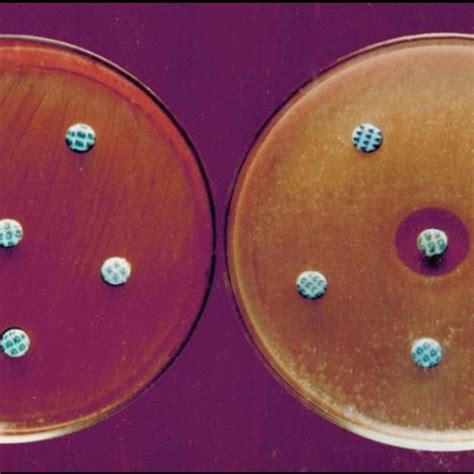 Pdf Antibiogram Analysis Of Gram Negative Bacterial Isolates From