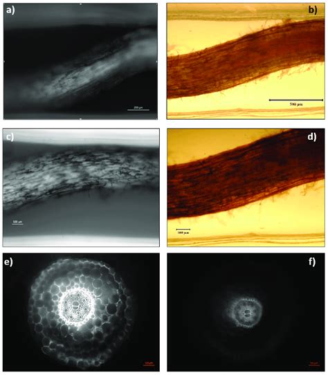 Neutral Red Staining Of Root Seen Under Light And Fluorescent