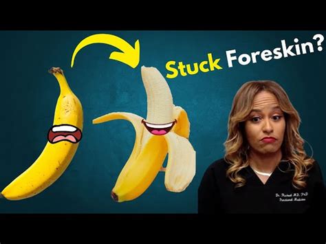 What To Do If You Have A Tight Foreskin Aka Phimosis 41 Off