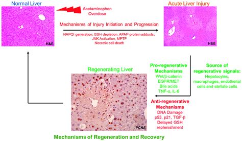 Schematics Showing An Overview Of The Process Of Liver Regeneration And