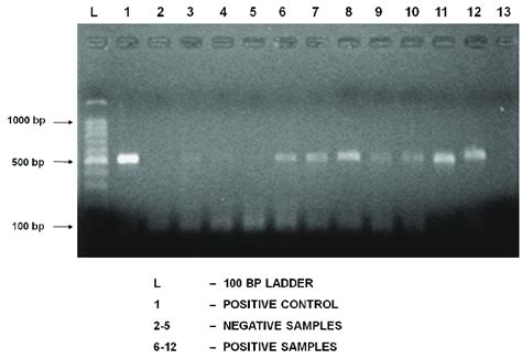 Figure Reverse Transcriptase Polymerase Chain Reaction For Dengue Download Scientific Diagram