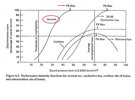 Speech Audiometry Flashcards Quizlet