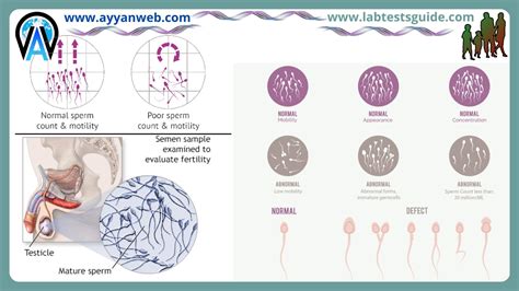 Semen Analysis Test Defination Purpose Results And More